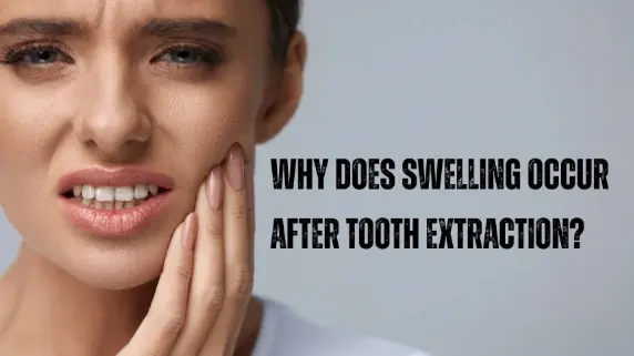 Why Does Swelling Occur After Tooth Extraction? - Community Health ...